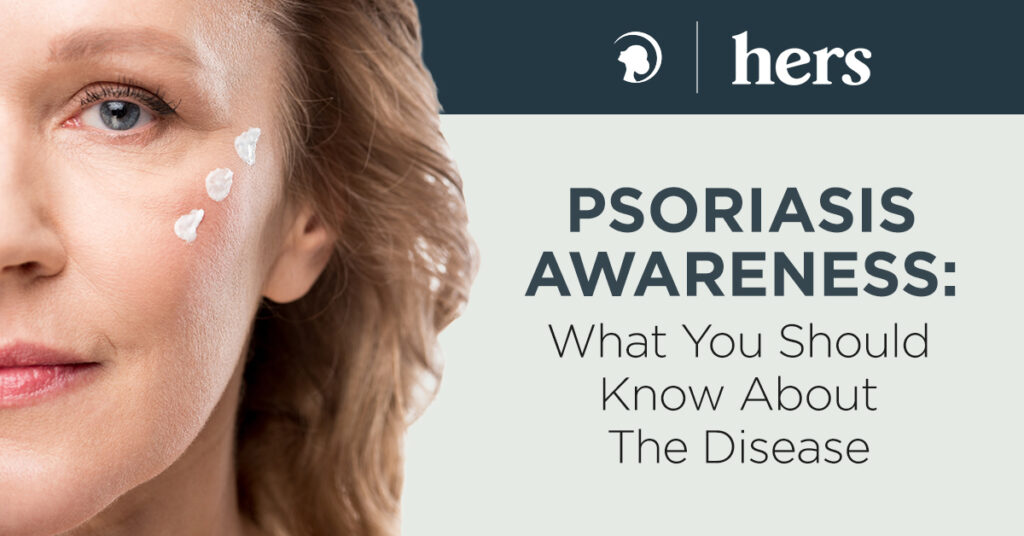 What You Should Know About Psoriasis | 5 Important Facts