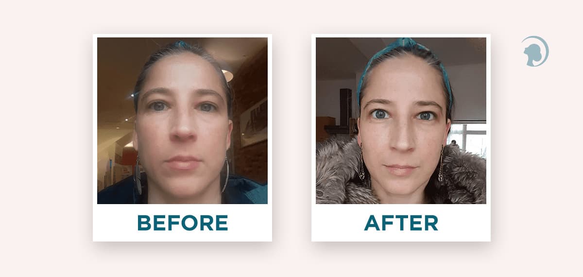 10 Astonishing Before And After Face Yoga Transformations