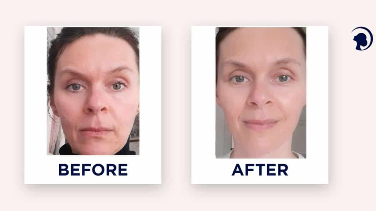 Face Workouts: The Science Behind Their Benefits