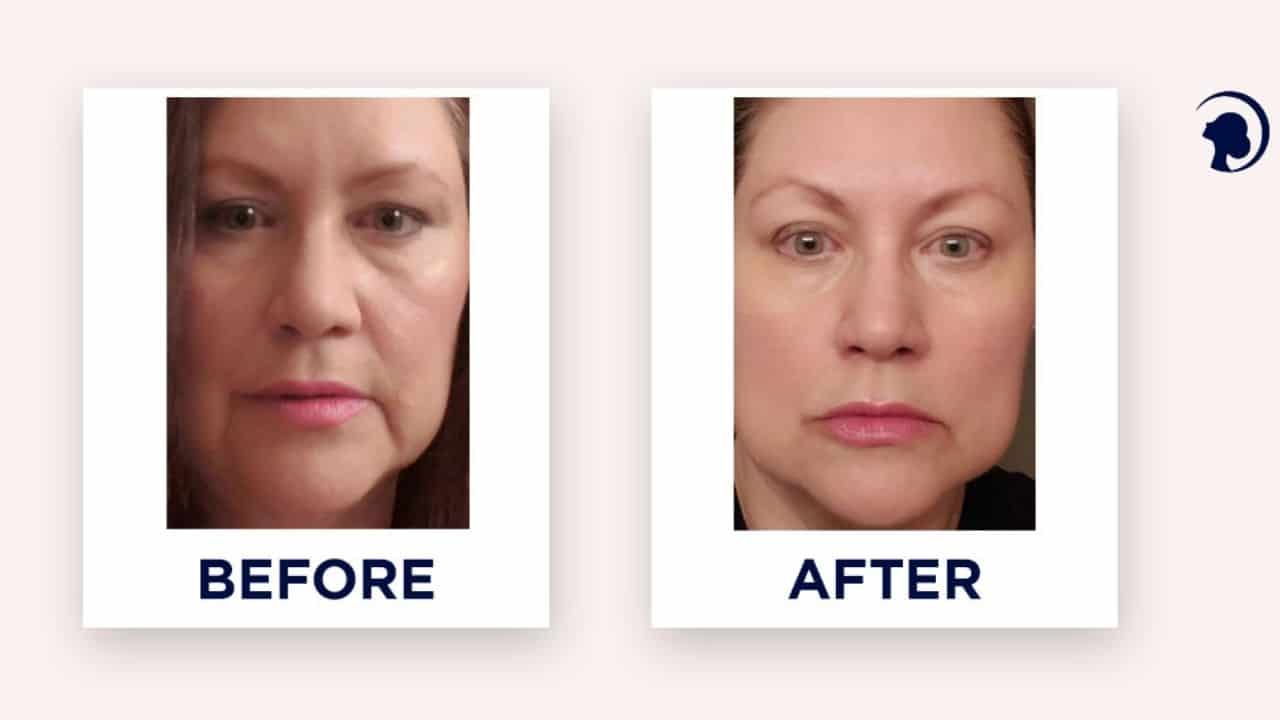 Face Workouts: The Science Behind Their Benefits